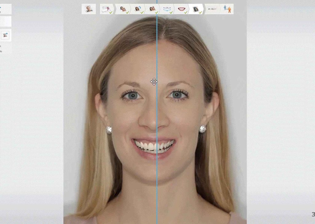 Smile Makeover - Smilogy